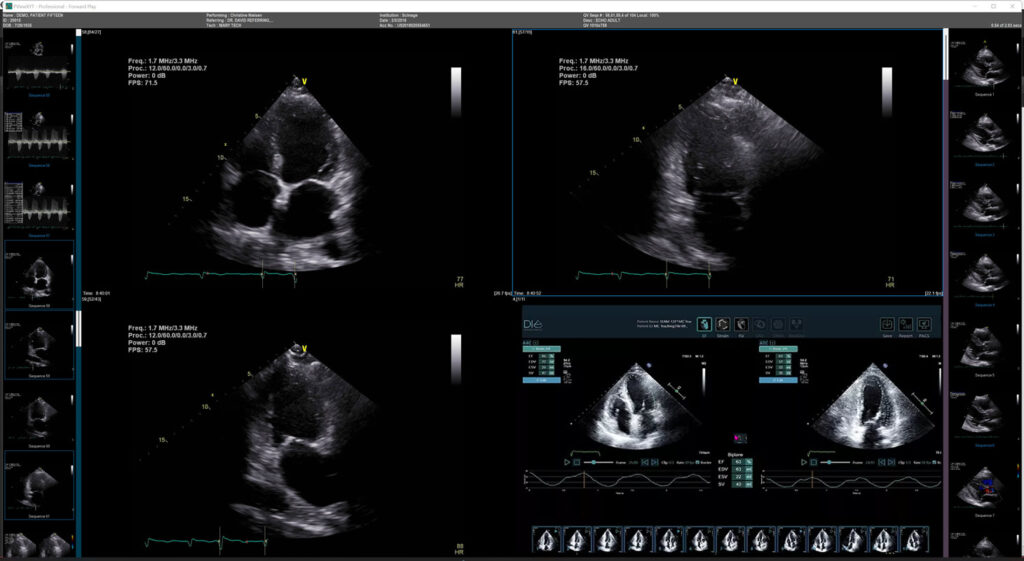 Introduction to PACS in Cardiology - ScImage